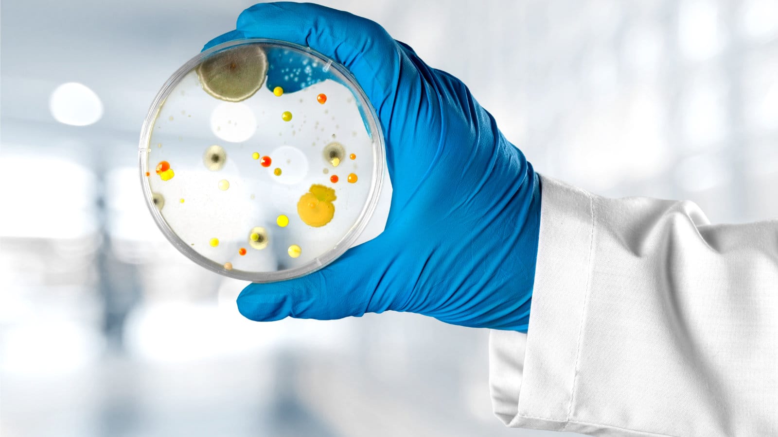 Understanding Bacteria in Well Water: Essential Insights for Well ...